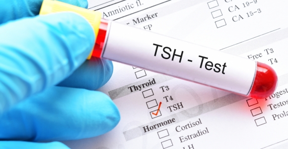 What is TSH? - Facty Health